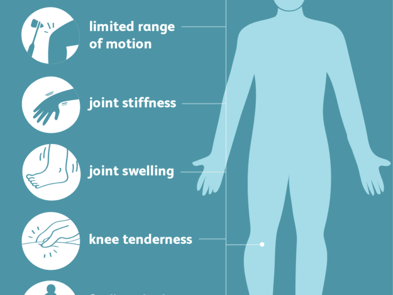 Arthritis: Causes, Symptoms and Treatment – Aidan Culhane